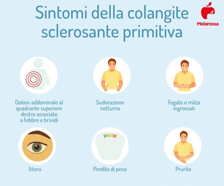 Colangite: cos’è, sintomi, cause e trattamento