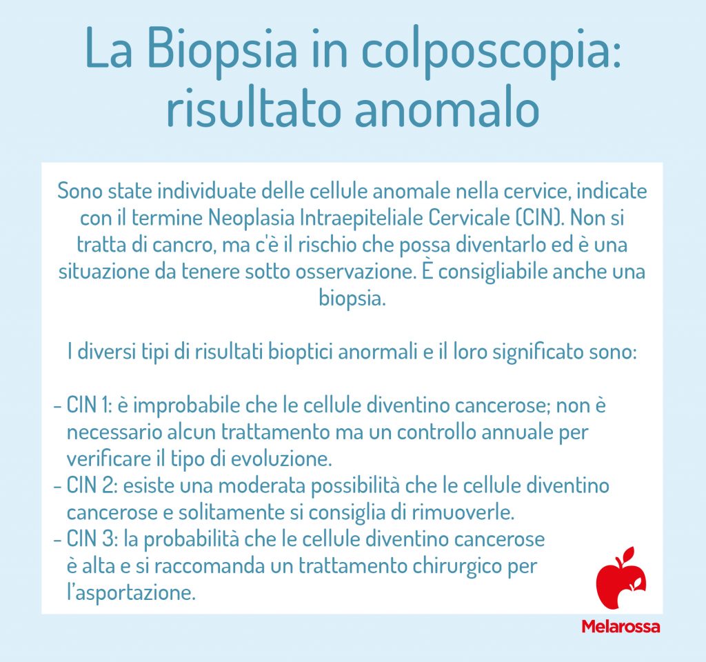 Colposcopia: cos’è, a cosa serve, quando è consigliata, quanto è dolorosa