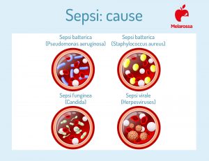 Setticemia: cos'è, sintomi, cause, cura e trattamento