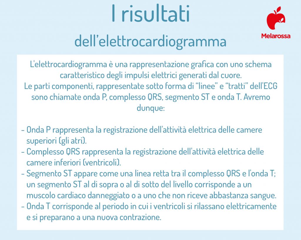 elettrocardiogramma: che cos'è, come funziona e cosa si vede
