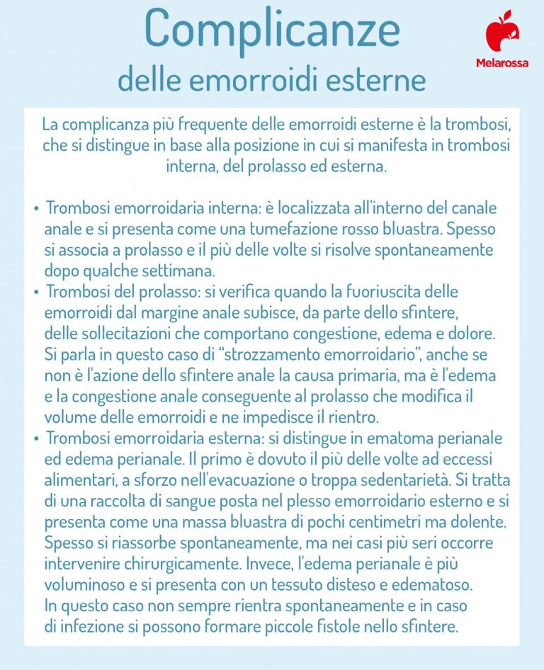 Emorroidi esterne: cosa sono, sintomi, diagnosi e cura