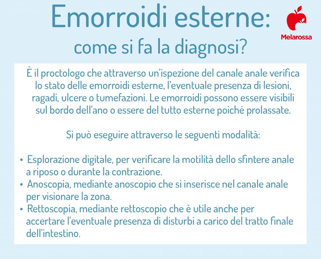 Emorroidi esterne: cosa sono, sintomi, diagnosi e cura