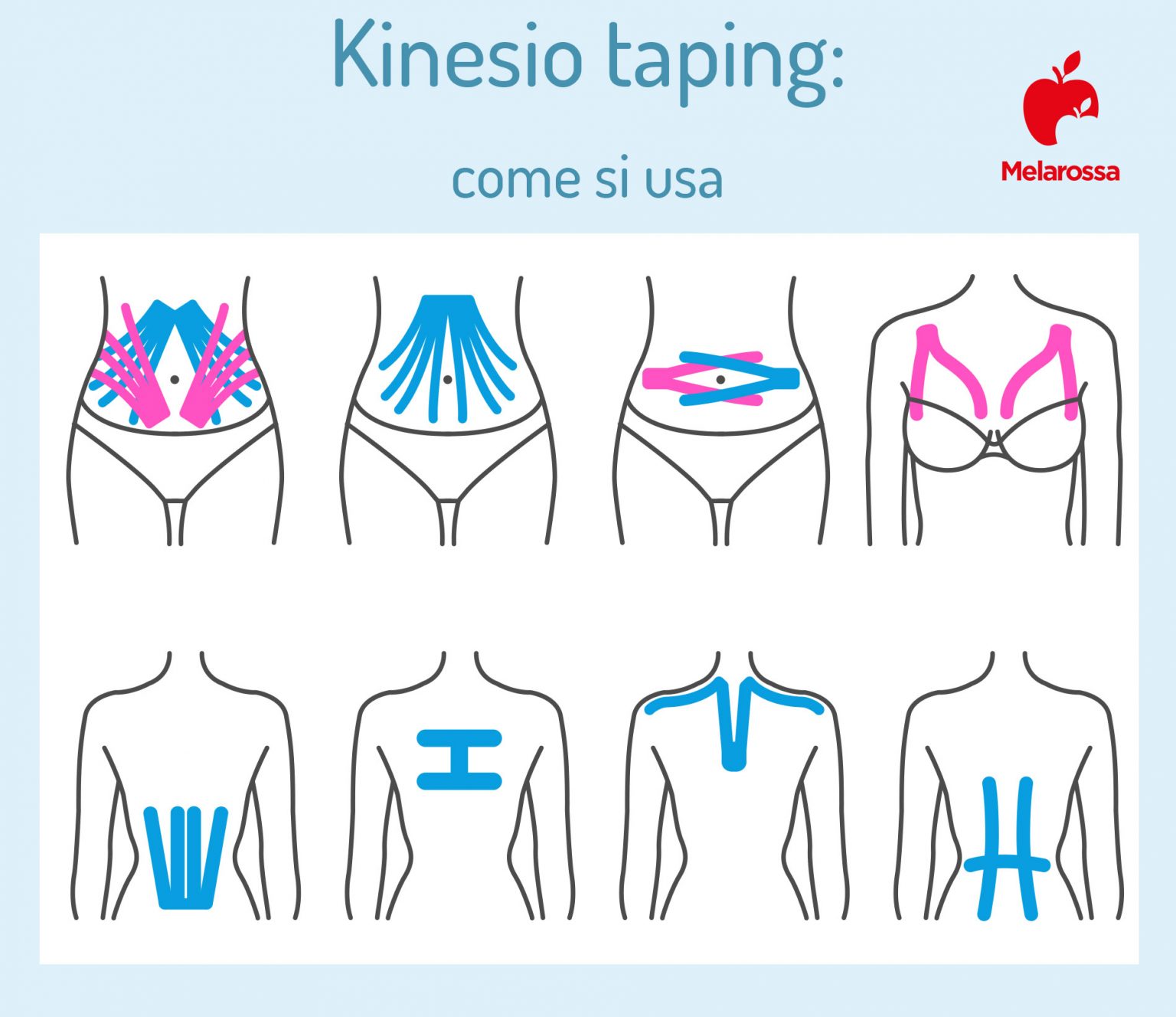 Kinesio taping: che cos'è, a cosa serve, come si usa, benefici