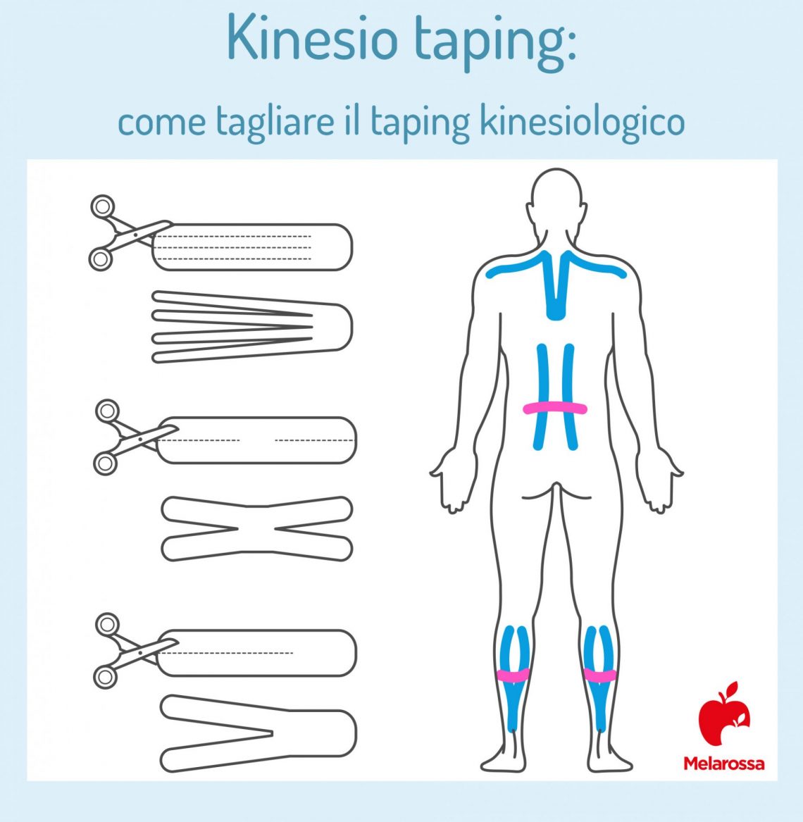 Kinesio taping: che cos'è, a cosa serve, come si usa, benefici