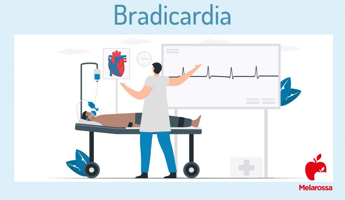 Bradicardia: che cos'è, cause, sintomi, diagnosi, cure