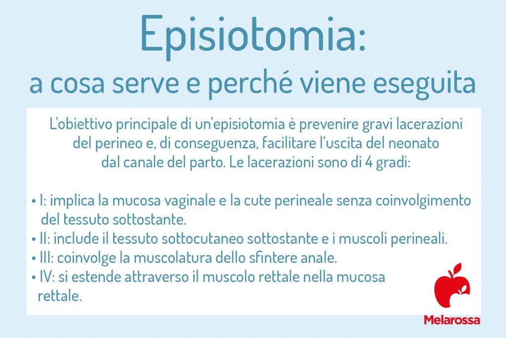 Episiotomia: che cos'è, come si fa, a cosa serve, conseguenze