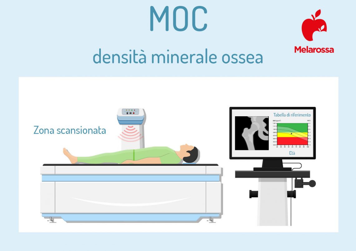 Moc: che cos'è, perché farla, come leggere i valori