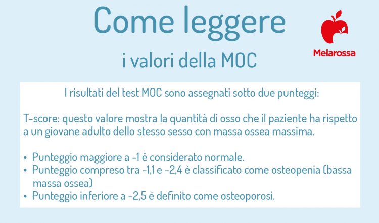 Moc: che cos'è, perché farla, come leggere i valori