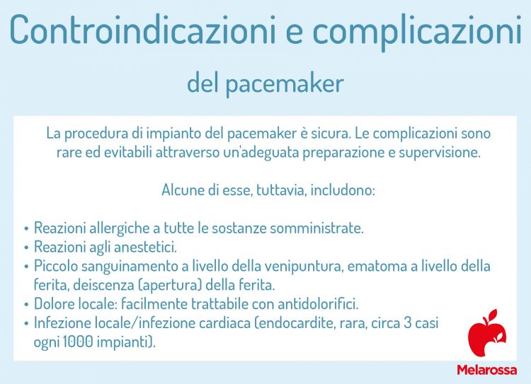 Pacemaker: che cos'è, come funziona, come si impianta, benefici