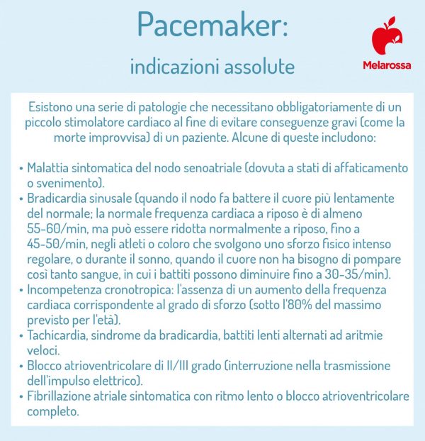 Pacemaker: che cos'è, come funziona, come si impianta, benefici