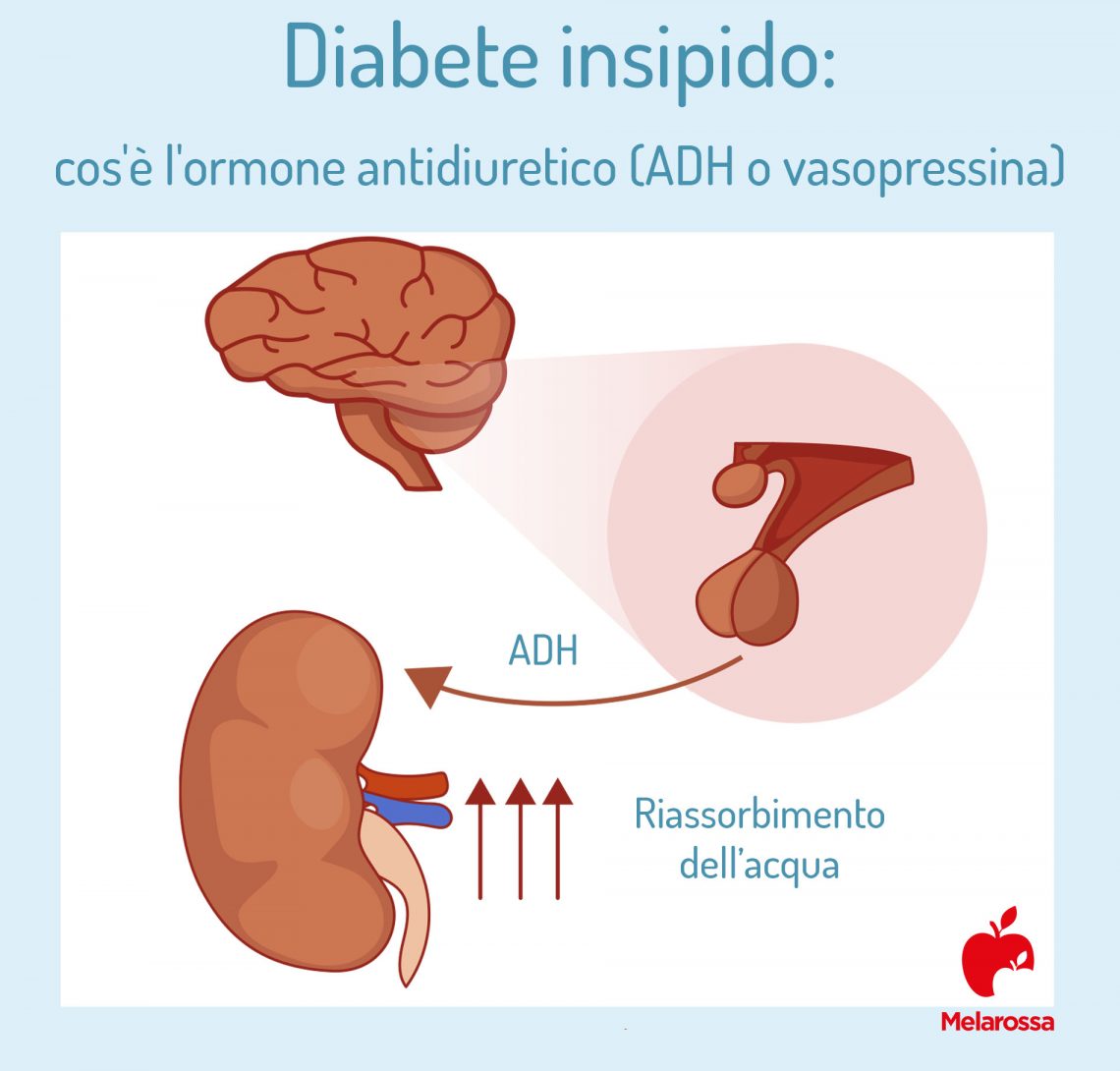 Diabete insipido: che cos'è, cause, sintomi, diagnosi e come curarlo