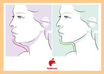 Doppio mento: cause, rimedi e come si elimina