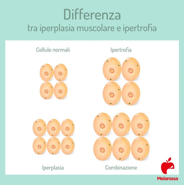 Ipertrofia muscolare: come aumentare la massa muscolare