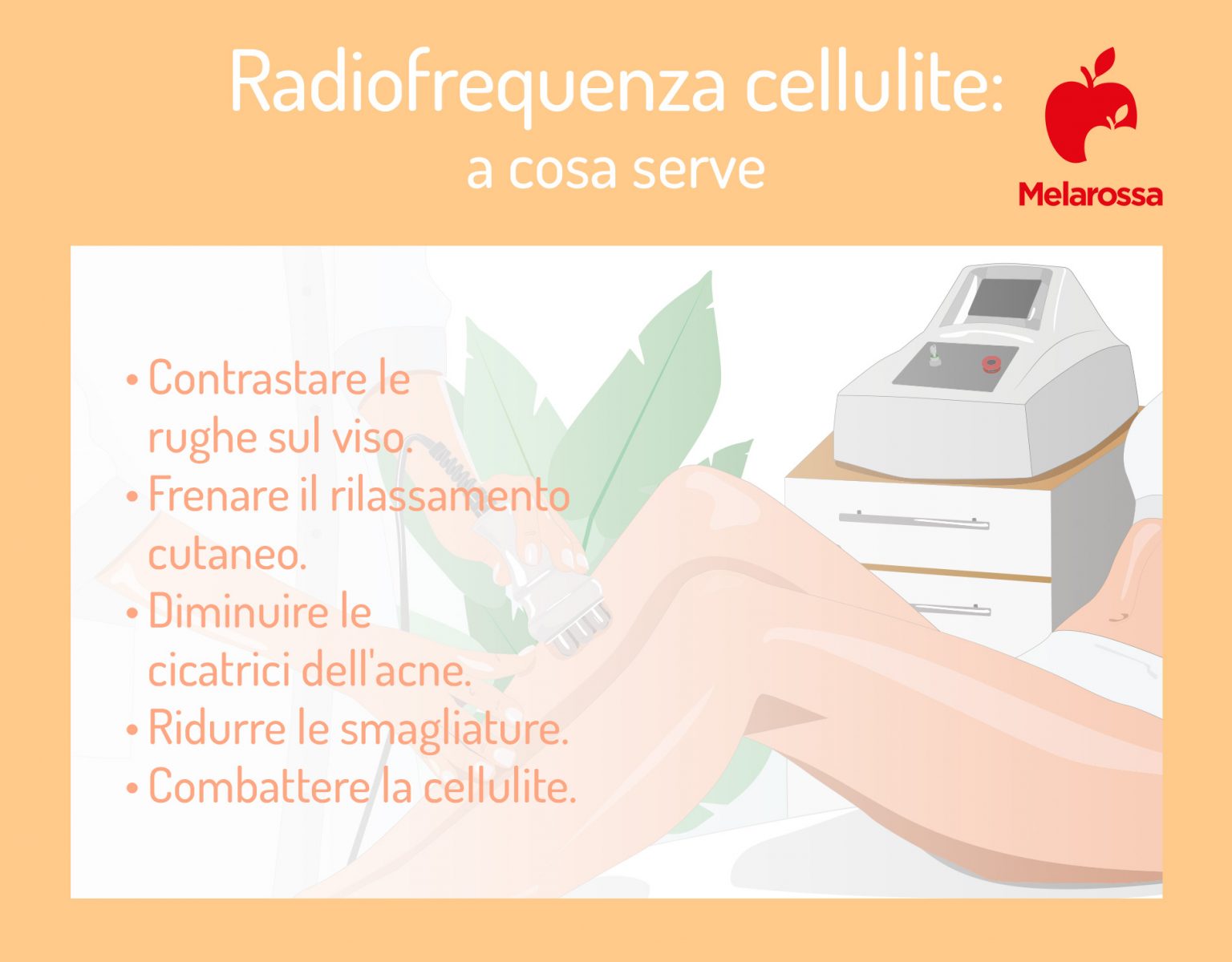 Radiofrequenza anti cellulite: come funziona e costi - Melarossa