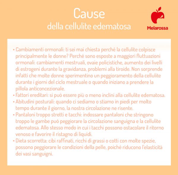 Cellulite edematosa: che cos'è, cause, come eliminarla