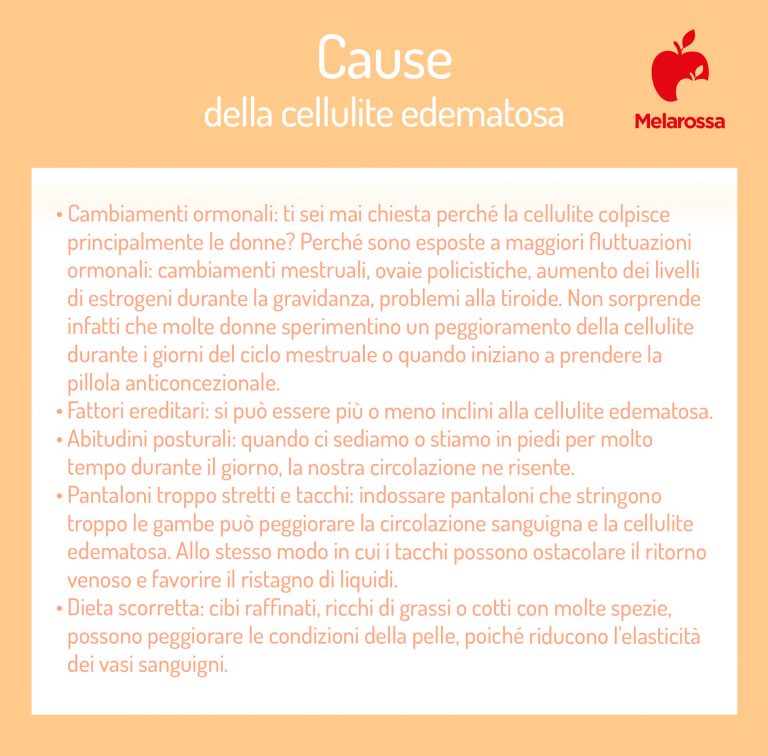 Cellulite edematosa: che cos'è, cause, come eliminarla