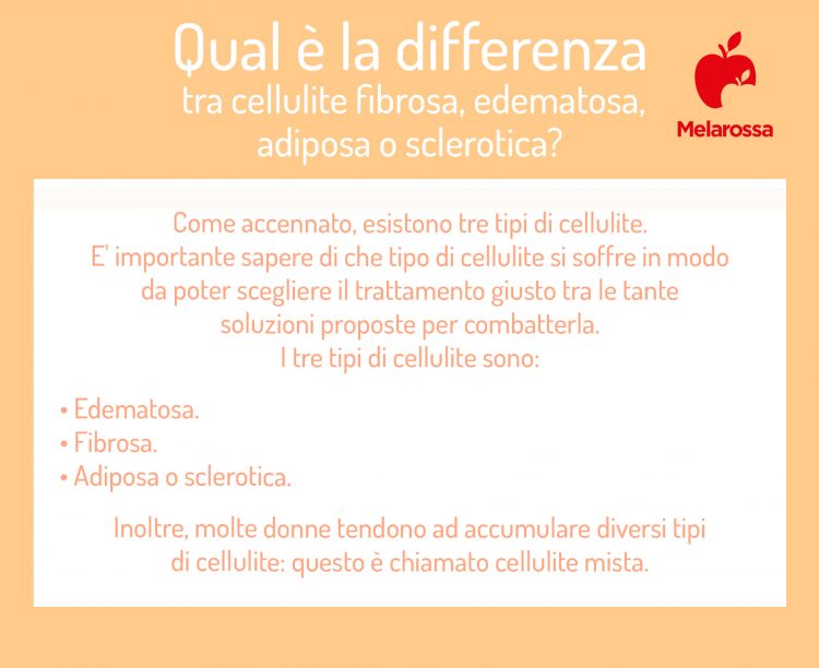 Cellulite edematosa: che cos'è, cause, come eliminarla