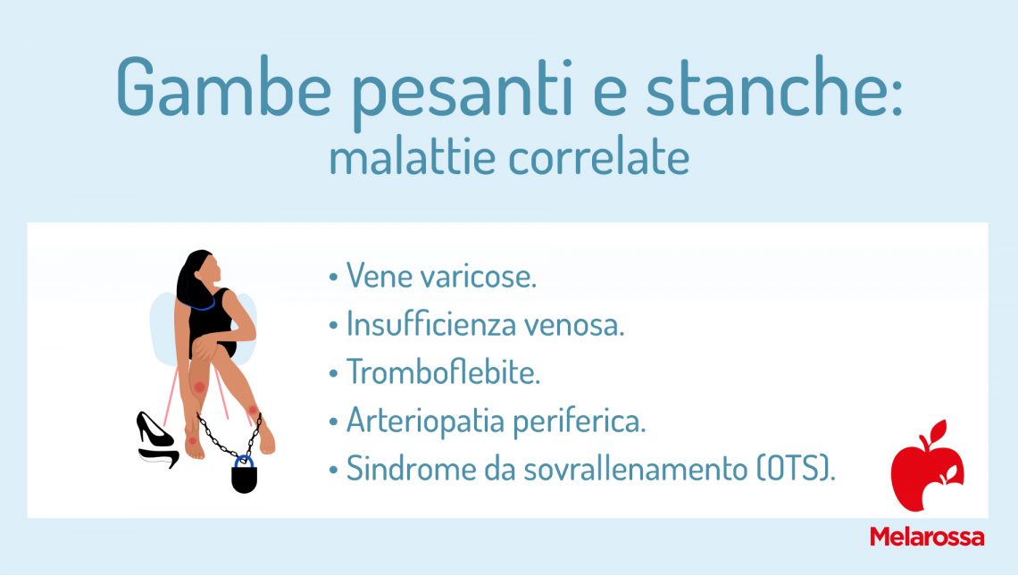 Gambe pesanti e stanche, scopri le cause e i rimedi - Melarossa