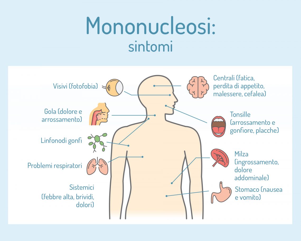 Placche in gola: cosa sono, sintomi, cause, rimedi efficaci