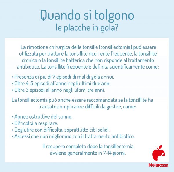 Placche in gola: cosa sono, sintomi, cause, rimedi efficaci